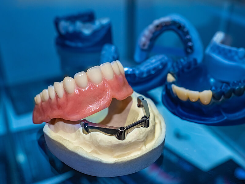 Próteses Dentárias - Descubra o modelo ideal para seu sorriso